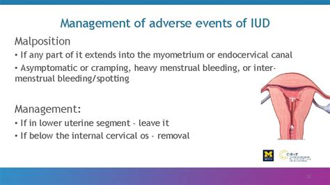 Intrauterine Devices Iud Part Ii Lia Tadesse Gebremehdin