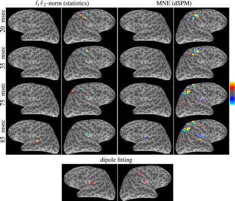 figure 7 from a distributed spatio temporal eeg meg inverse solver