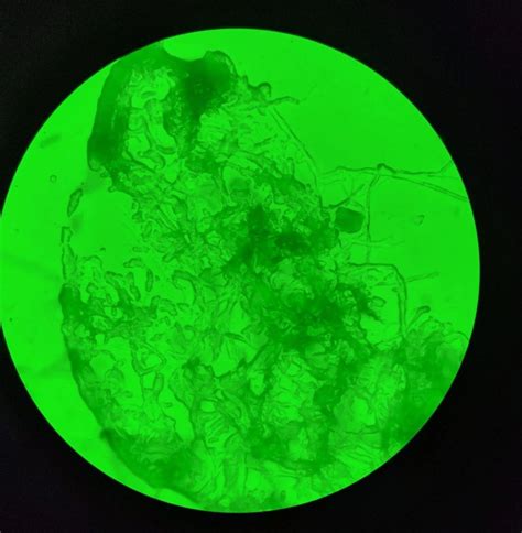 Saptarshi Mukherjee On Linkedin Research Work