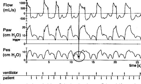 Rapid Interpretation Of Ventilator Waveforms Pdf Claire Scott