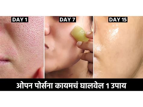 ओपन परसमळ चहर खरब डल झलय १ उपय तवच दसल नतळ सदर परस हतल बद Marathi