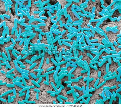 E Coli Microscope Over 568 Royalty Free Licensable Stock Illustrations And Drawings Shutterstock