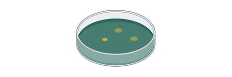 Oxidation Fermentation Test Result Principle Procedure