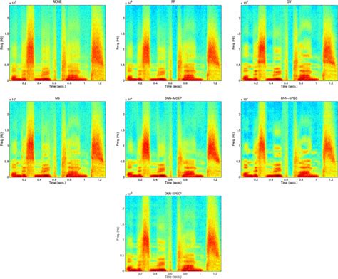 Spectrogram Of Utterance “on The Smooth Planks” Generated Using Download Scientific Diagram
