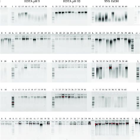 Visualization Of DNA Extracts By Gel Electrophoresis DNA Was Extracted