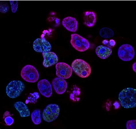 Key Metagenomics Techniques And Their Uses Cosmosid