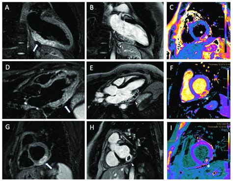A 41 Year Old Male Patient Underwent Cardiac Magnetic Resonance For