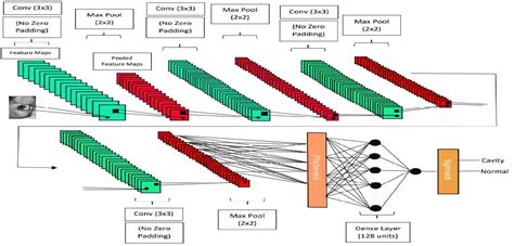 Figure 2 From Detection Of Cavities From Oral Images Using Convolutional Neural Networks