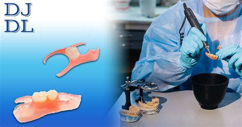 Everything About Nesbit Partials Dave Johnson Dental Lab