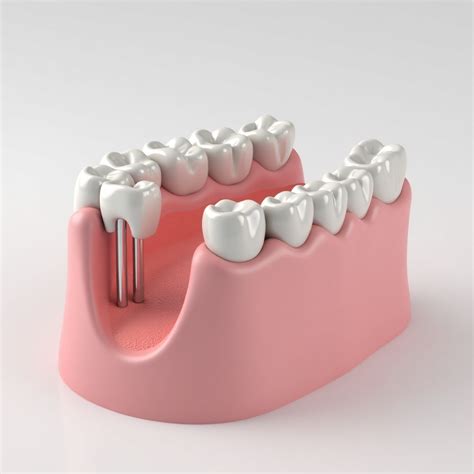 Elastomeric Closures Treatment Stable Diffusion Online