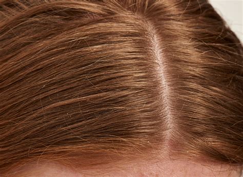 Scalp Health 101 The Inkey List