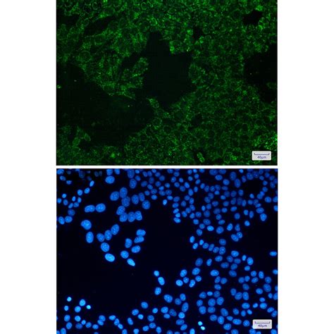 Sec61a Rabbit Mab Wb Ihc P Ihc F Ip Icc Buy Now