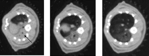 Left To Right Examples Of Computerized Tomography Ct Scan Slices