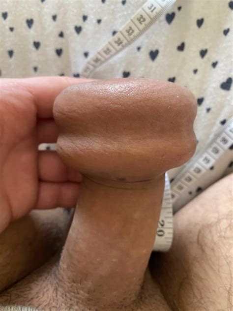 Foreskin Stretching Ring Porn 5 Nude Pics XHamster