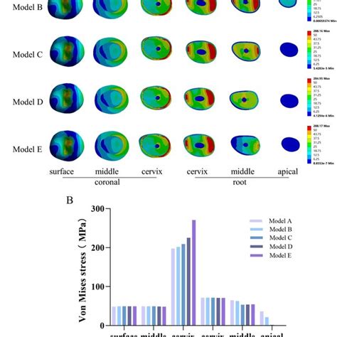 Stress Distribution And Tooth Displacement Distribution In Overall