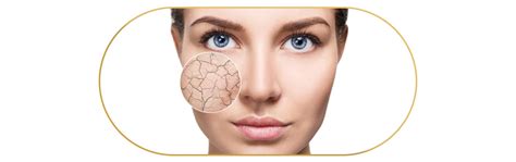 پوست دهیدراته چه فرقی با پوست خشک دارد؟؟ نیلی مگ