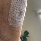 Fixing A G7 Sensor That Won T Pair Or Start R Dexcom