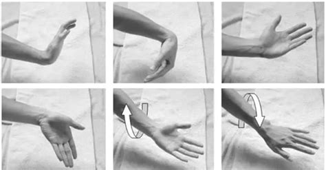 Tfcc损伤的诊断及关节镜治疗 骨科在线