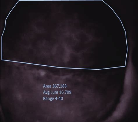 Example Of Polygon Creation To Evaluate Flap Surface Area And