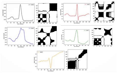 example of reccurence plot results for each class of ecg signals