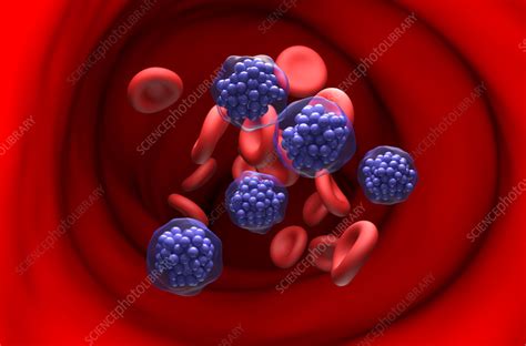 Diffuse Large B Cell Lymphoma Illustration Stock Image F042 8174 Science Photo Library