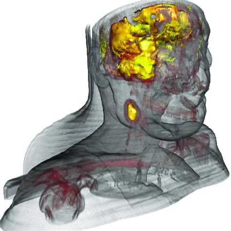 Example Of A Dual Histogram Which Is Needed To Estimate The Joint Download Scientific Diagram