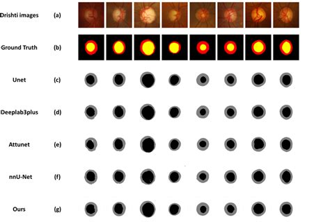 visualization of od and oc segmentation results on the drishti gs