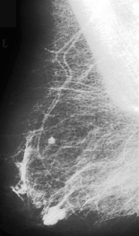 Automatic Pre Processing Download Scientific Diagram