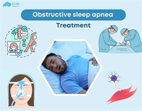Obstructive Sleep Apnea Treatment Comprehensive Guide