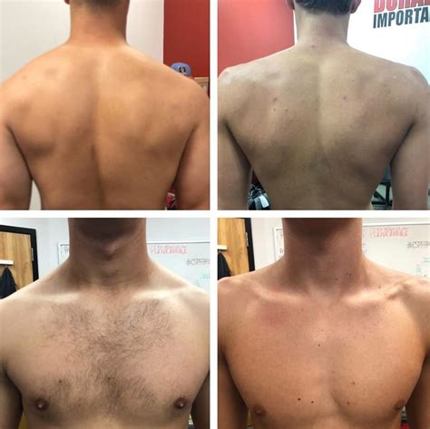 Narrow Shoulders Outlive