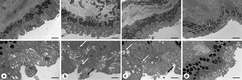 Electron Microscopy Of Ciliary Body A Control Eye Ciliary Body Cb Download Scientific