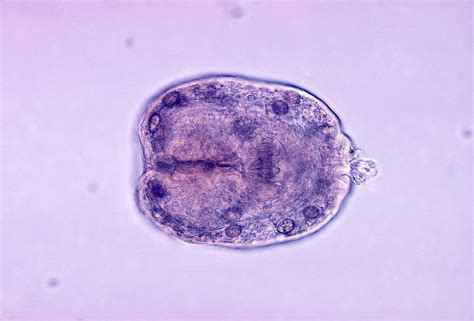 Echinococcus Granulosus Définition Et Explications