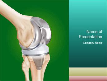 Orthopedic Surgery Prosthesis Of The Knee Procedure PowerPoint Template Backgrounds Google