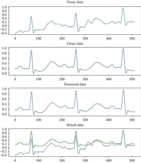 The Effect Of Removing Three Types Of Single Noise In The Ecg Signal Download Scientific