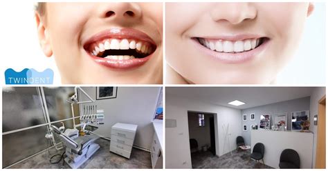 За искряща усмивка Преглед почистване на зъбен камък и полиране на зъби с Airflow разграбена