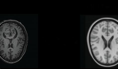 Mni Template Neuroconductor Example Fmri Task Processing Williamson