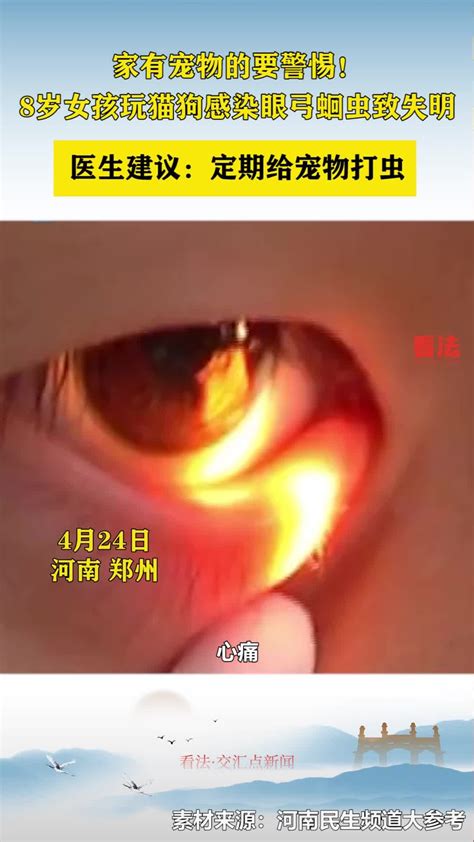 蛔虫眼睛症状 蛔虫成虫 第8页 大山谷图库