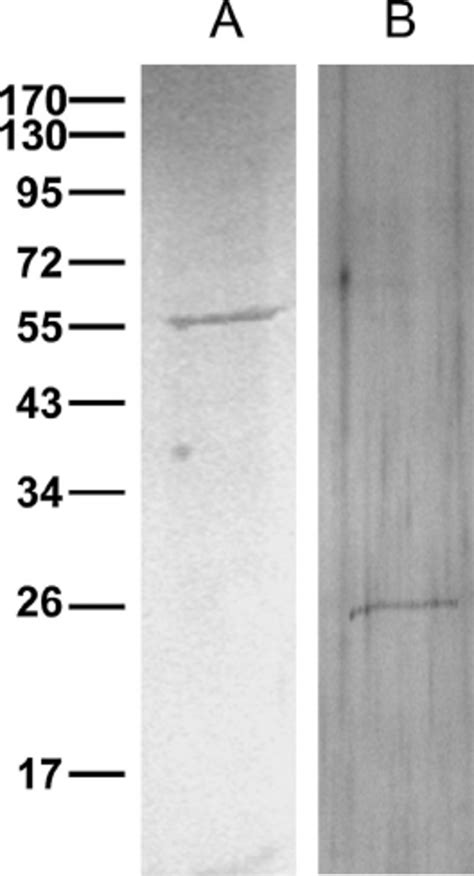 Urea Effect Of Purified Protein A The Purified Protein Was Mixed With Download Scientific