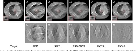 Figure 1 From Prior Image Constrained Iterative Reconstruction With Adaptive Step Size For