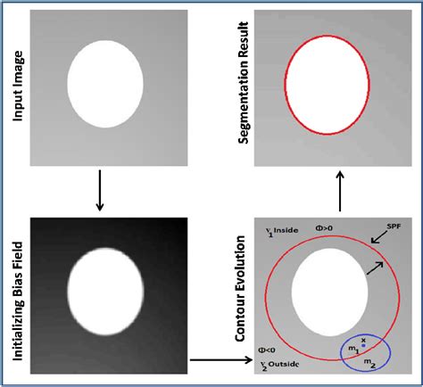 Figure 3 From Edge Based Local And Global Energy Active Contour Model Driven By Signed Pressure