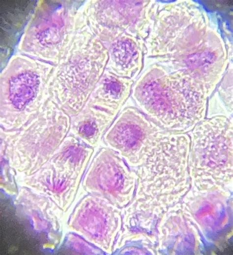 Metaphase Microscope