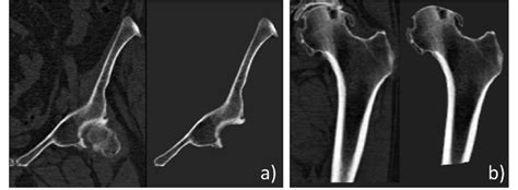 Example Of Reconstructed Intensities After Encoding With Bernstein