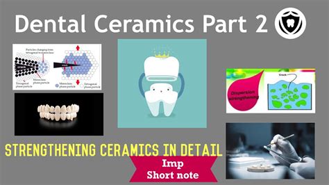 Dental Ceramics Part 2 Youtube