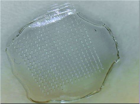 Cmc Mal Microneedle Array Structure Consisting Of 324 Needles Of Height