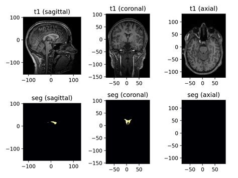 How To Use Sampler In Dataset With Different Size Issue 360