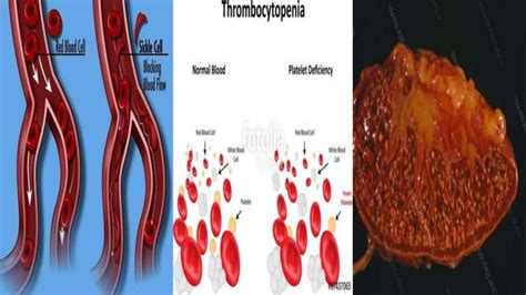 Components Development And Functions Of Res Reticulo Endo Thelial Cells Pptx