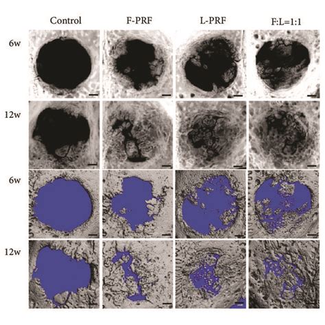 Bone Regeneration In Rabbit Critical Size Calvarial Defects And Download Scientific Diagram
