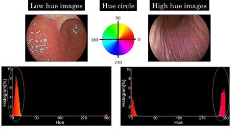 Linked Color Imaging Images Were Classified Into Two Groups Based On A Download Scientific