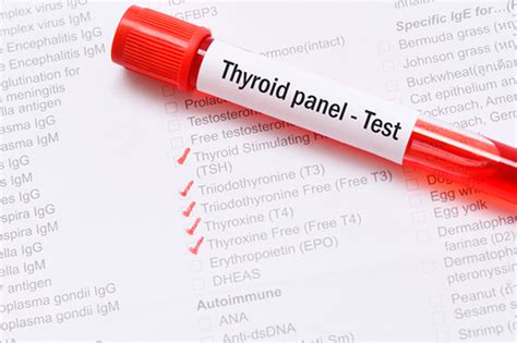 Thyroid Panel Test A Comprehensive Guide To Thyroid Health Speedy Sticks Mobile Lab Services