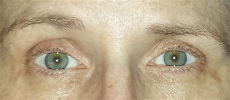 Ask Julie Fast Come On Can You Really Tell You Are Manic By Looking In Your Eyes « Straight